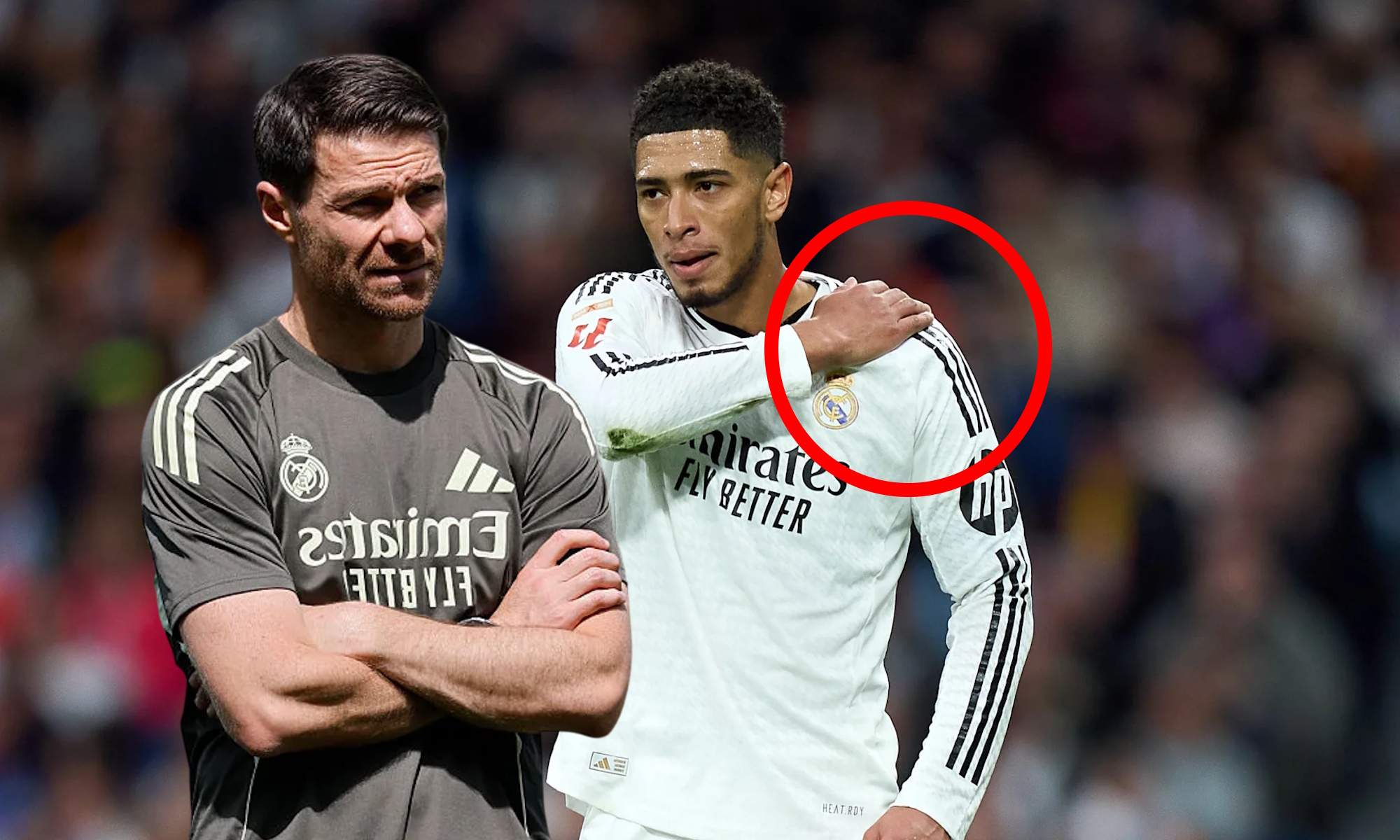 El peor pronóstico posible para Bellingham tras su operación, drama para Xabi Alonso